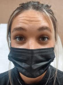 Botox Miami | Botox Injections in Miami & Coral Gables, FL